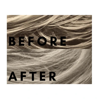 Scalpfix™ – Private Edition Nashville